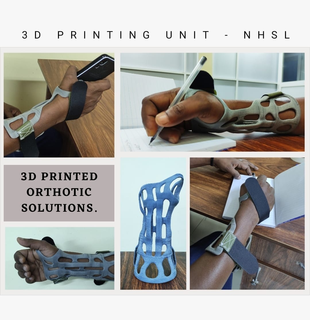 3D printing technology for trauma rehabilitation | National Trauma ...